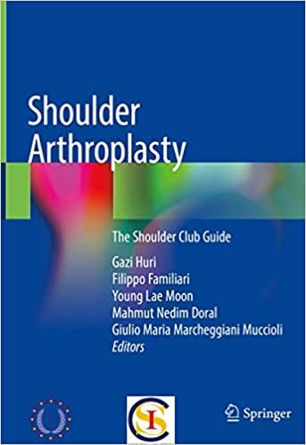 Shoulder Arthroplasty The Shoulder Club Guide - Books Delivery Pk ...