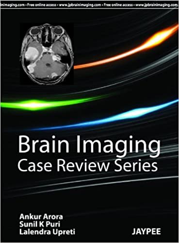 Brain Imaging Case Review Series - Books Delivery Pk Online Book Shop