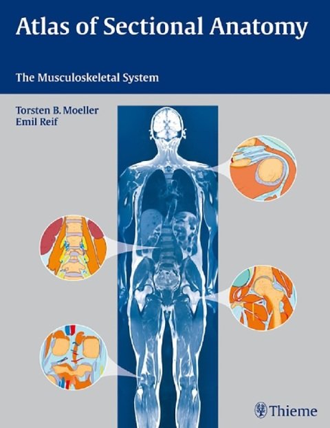Atlas of Sectional Anatomy The Musculoskeletal System
