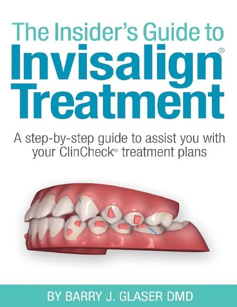Insiders Guide to Invisalign Treatment
