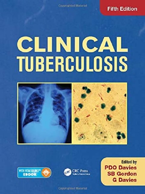 Clinical Tuberculosis 5th Edition